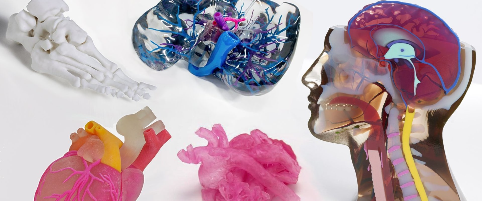 How is 3d printing used to create personalized prosthetics and implants ...