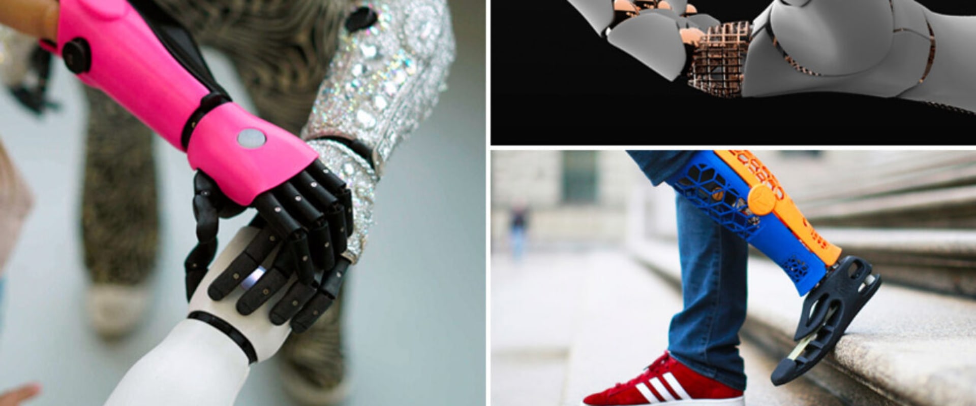 How is 3d printing used in prosthetics?